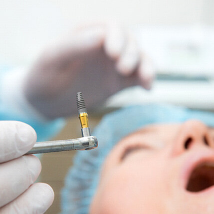 Guided Dental Implant Surgery Concord, NH | Charm Smile Dental